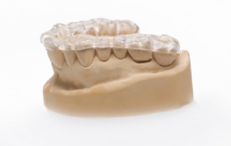 Splints – Nightguards – Anti-snoring braces - Dental Labo Vanderbeken
