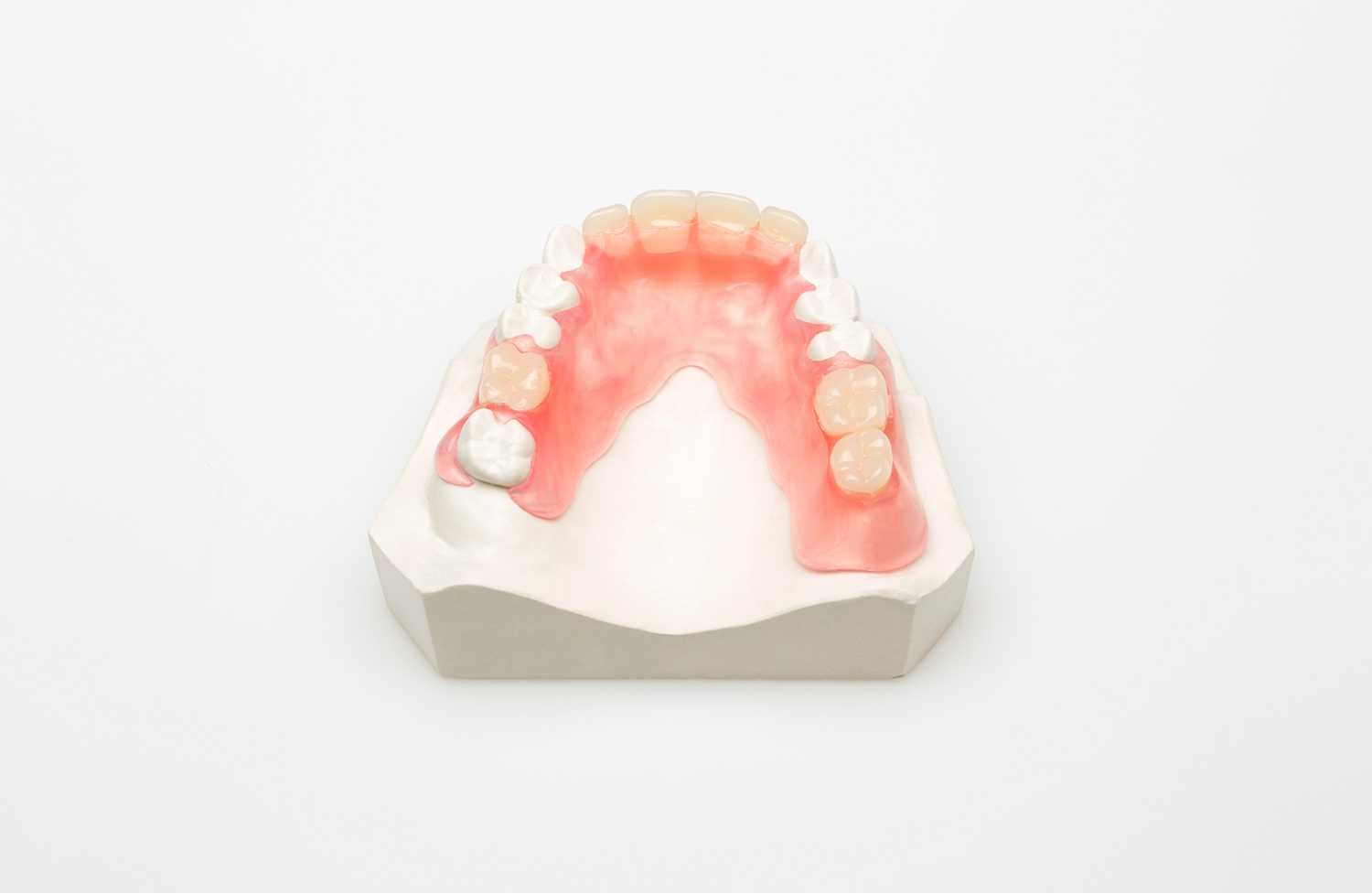 Flexibele prothesen - Dental Labo Vanderbeken