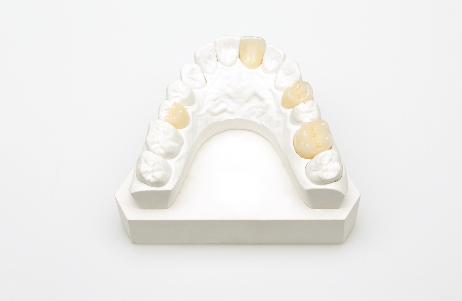 Lithium Disilicate - Dental Labo Vanderbeken