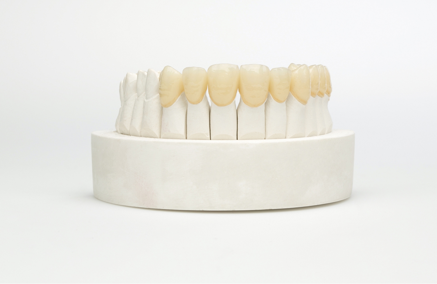 Lithium Disilicate - Dental Labo Vanderbeken