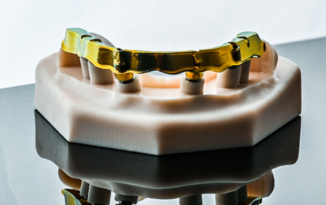i-Bridge - Dental Labo Vanderbeken